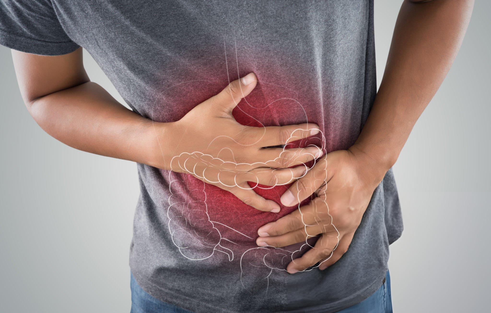 Can Hijama Help With My Constipation & Smoking Habit? – Hijama Nation